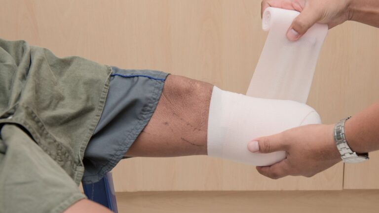 What Compensation Can You Get for an Amputation Injury? - Paganpressbooks